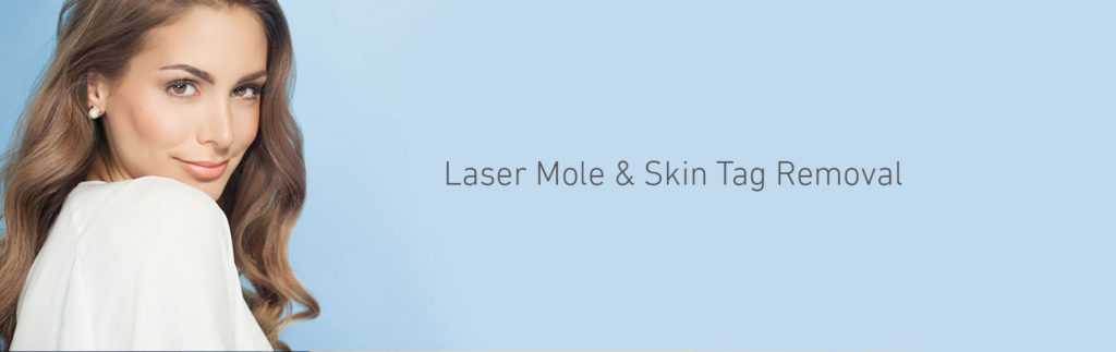 Laser Skin Tag & Mole Removal | Southampton Hampshire Clinics